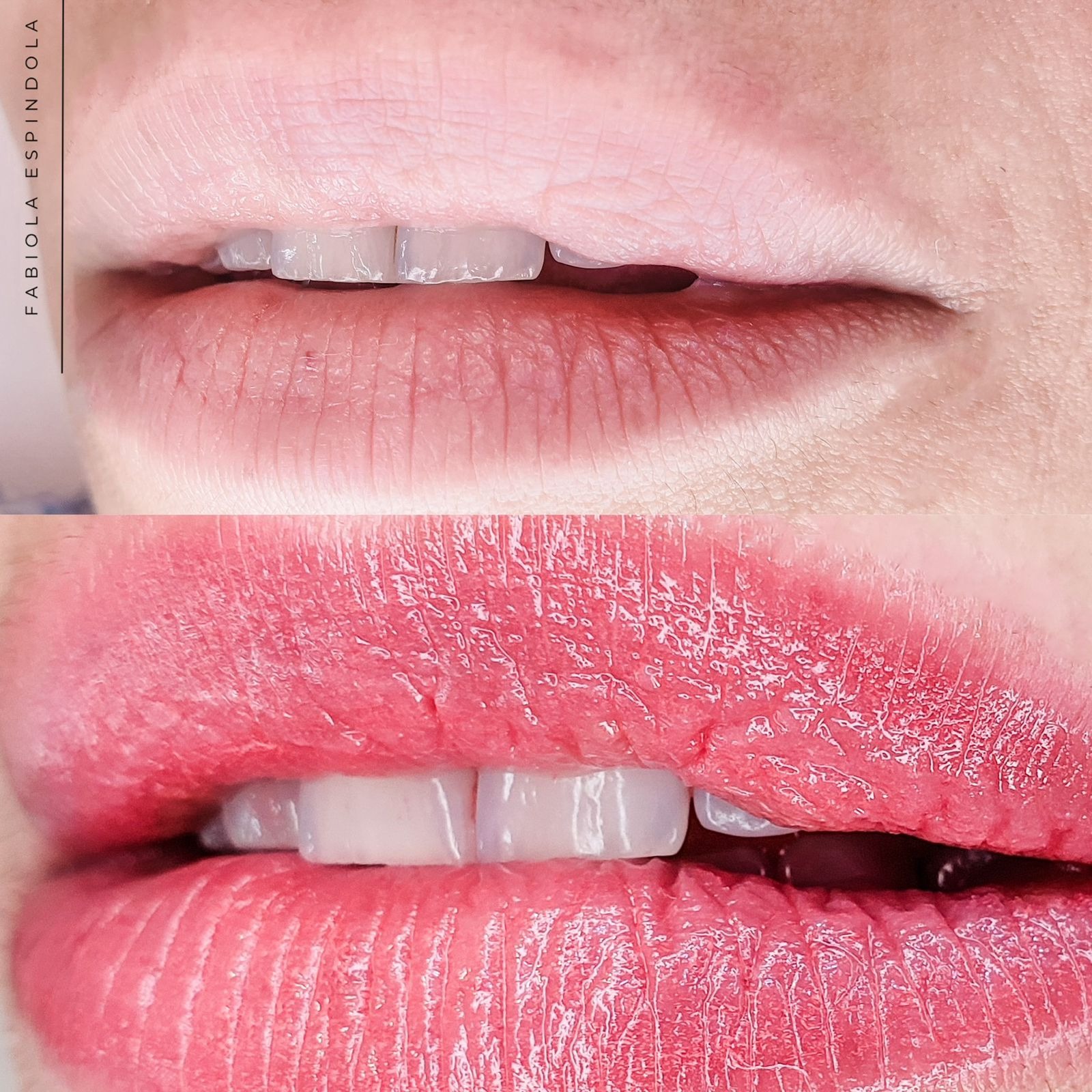 Micro Labial Efeito Lip Tint | L'amour Clinique
